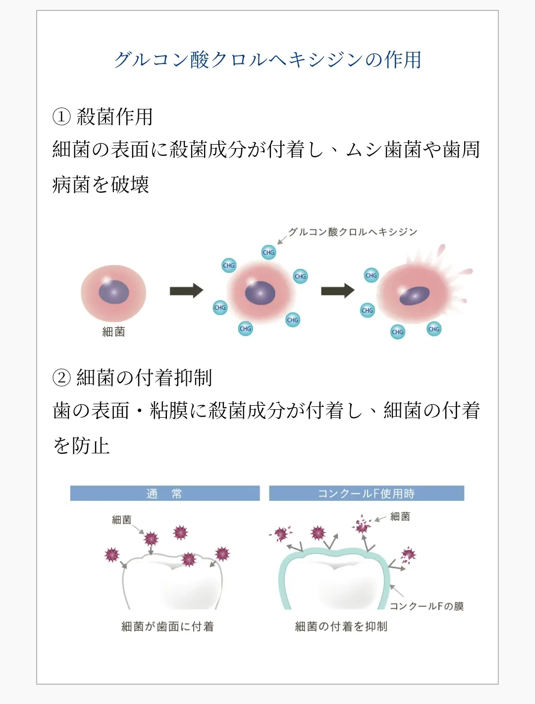 日本Weltec ConCool F 牙周專用護理漱口水 100ml - GeminiHKShop - GeminiHKShop